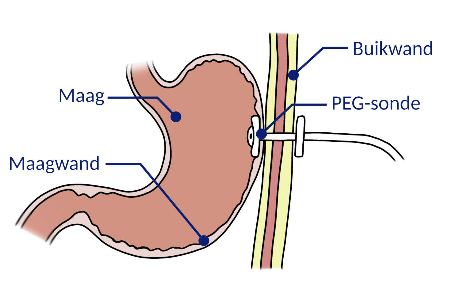 PEG-app: zelfzorg-apps ter bevordering van de zelfredzaamheid van ...